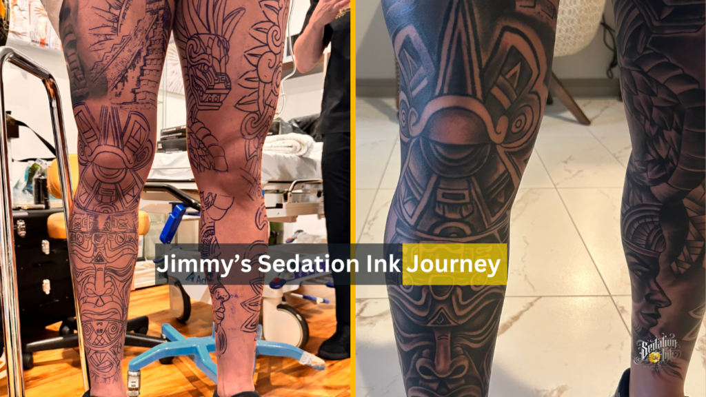 JIMMY'S SEDATION INK JOURNEY - Sedation Ink